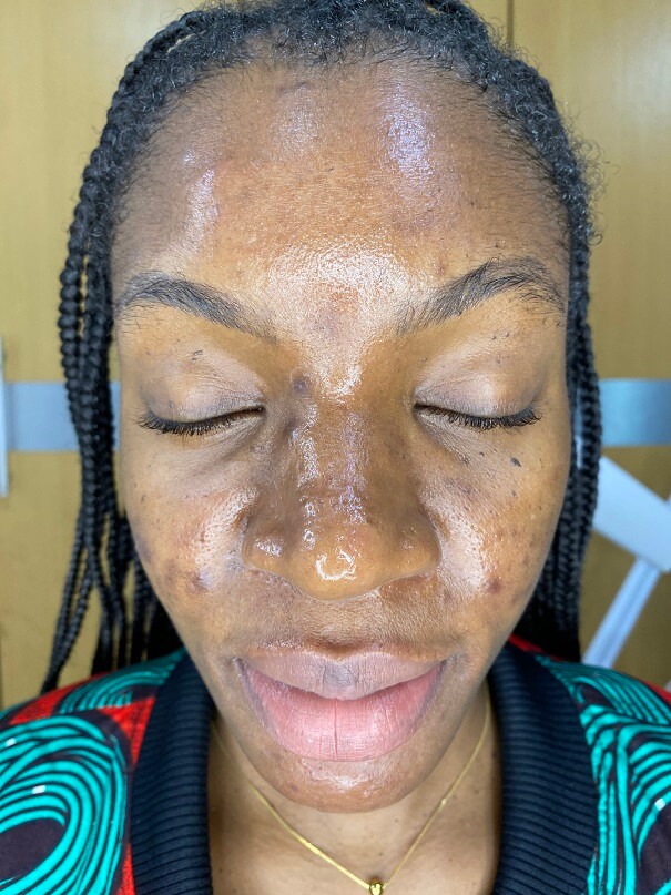 Skincare Products & Corrective Treatments | Home - Vhue Skin