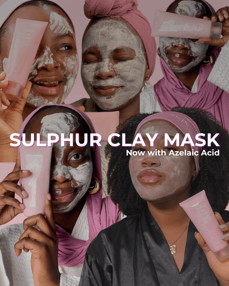 Sulphur (Sulfur) Clay Mask - Vhue Skin